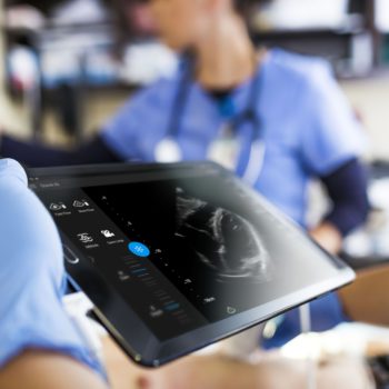 UItrassom Portátil Philips Lumify - Tecnolife