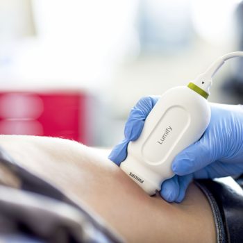 UItrassom Portátil Philips Lumify - Tecnolife