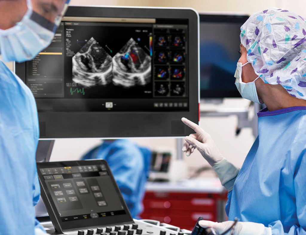 Ultrassom Philips EPIQ CVx - Tecnolife