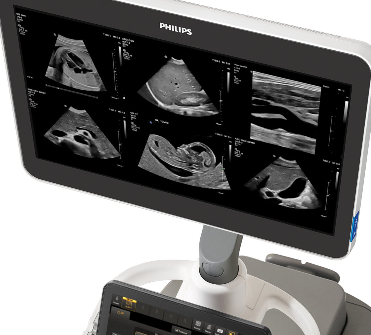 Ultrassom Philips EPIQ Elite - Tecnolife