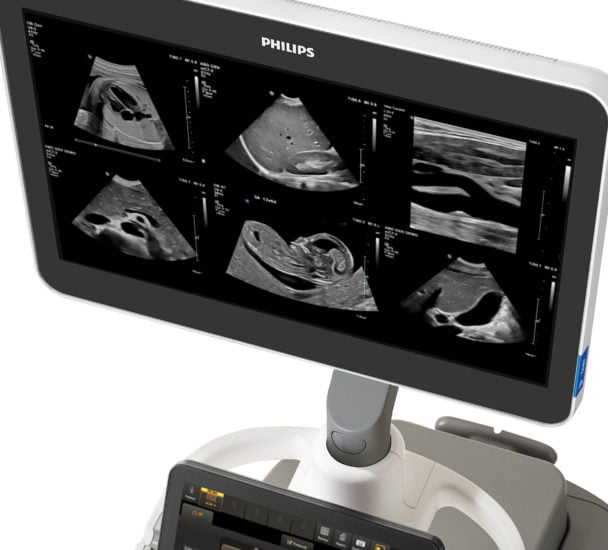 Ultrassom Philips EPIQ Elite - Tecnolife