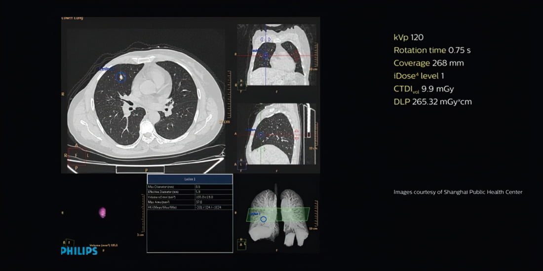 Tomógrafo Philips Access CT de 6, 16 e 32 cortes - Tecnolife