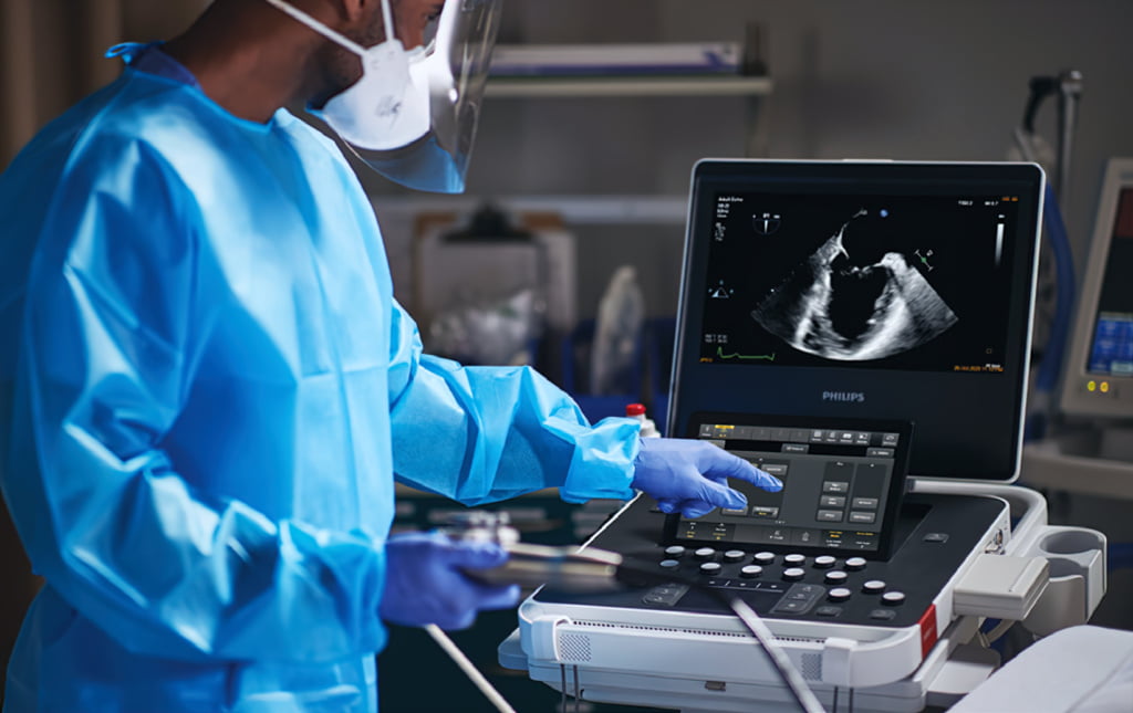 Philips apresenta novo sistema de ultrassom Compact 5000 na JPR 2023 ...